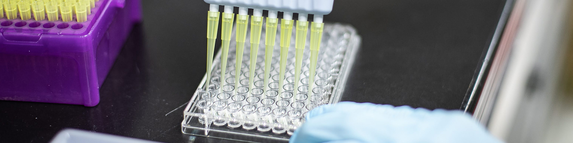 RESEARCH – Biochemical Engineering Lab., Dept. of Biotechnology ...